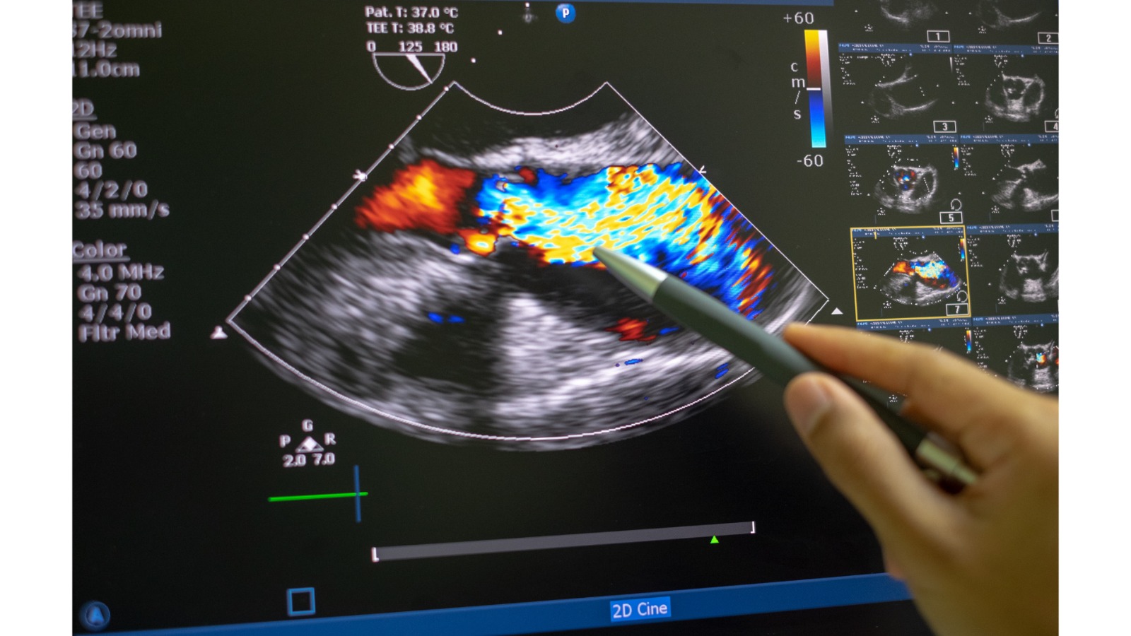 Bolile venoase și arteriale - eco Doppler, diagnostic și tratament